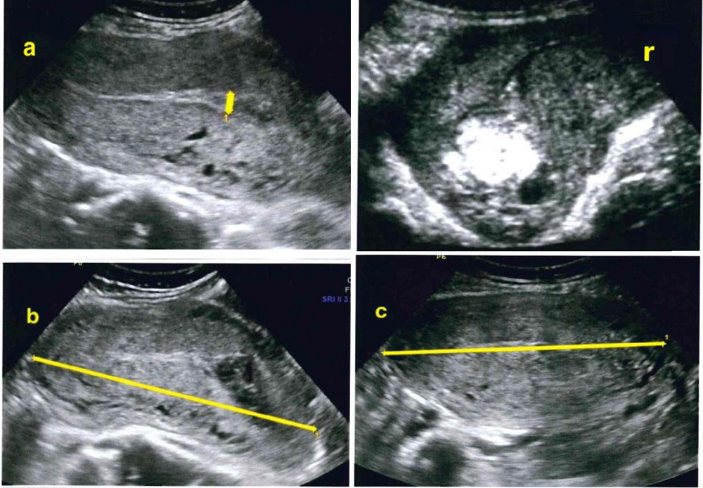 Ultrasound by midwives in the postpartum period: feasibility ...