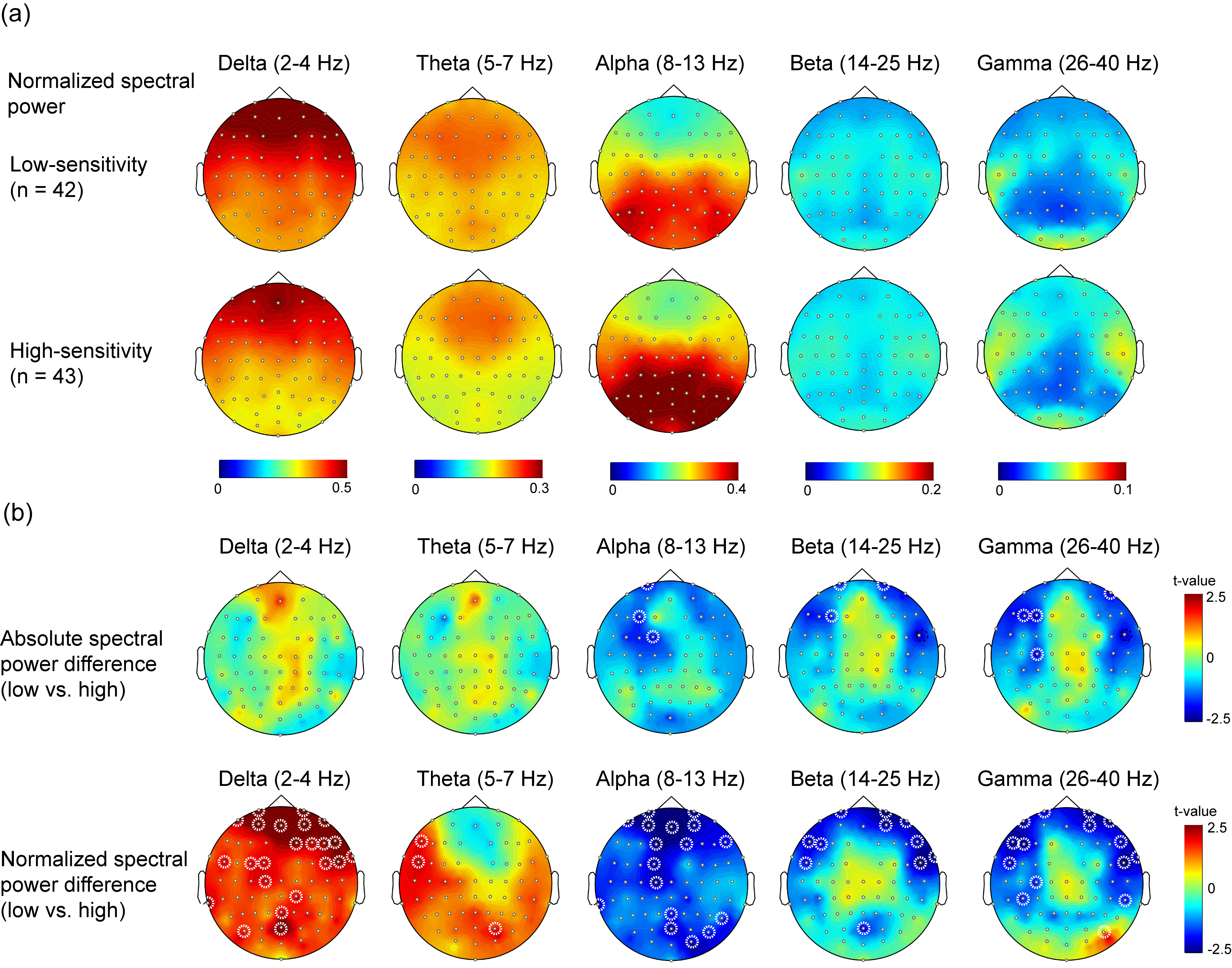 Machine learning–based prediction of heat pain sensitivity by using ...
