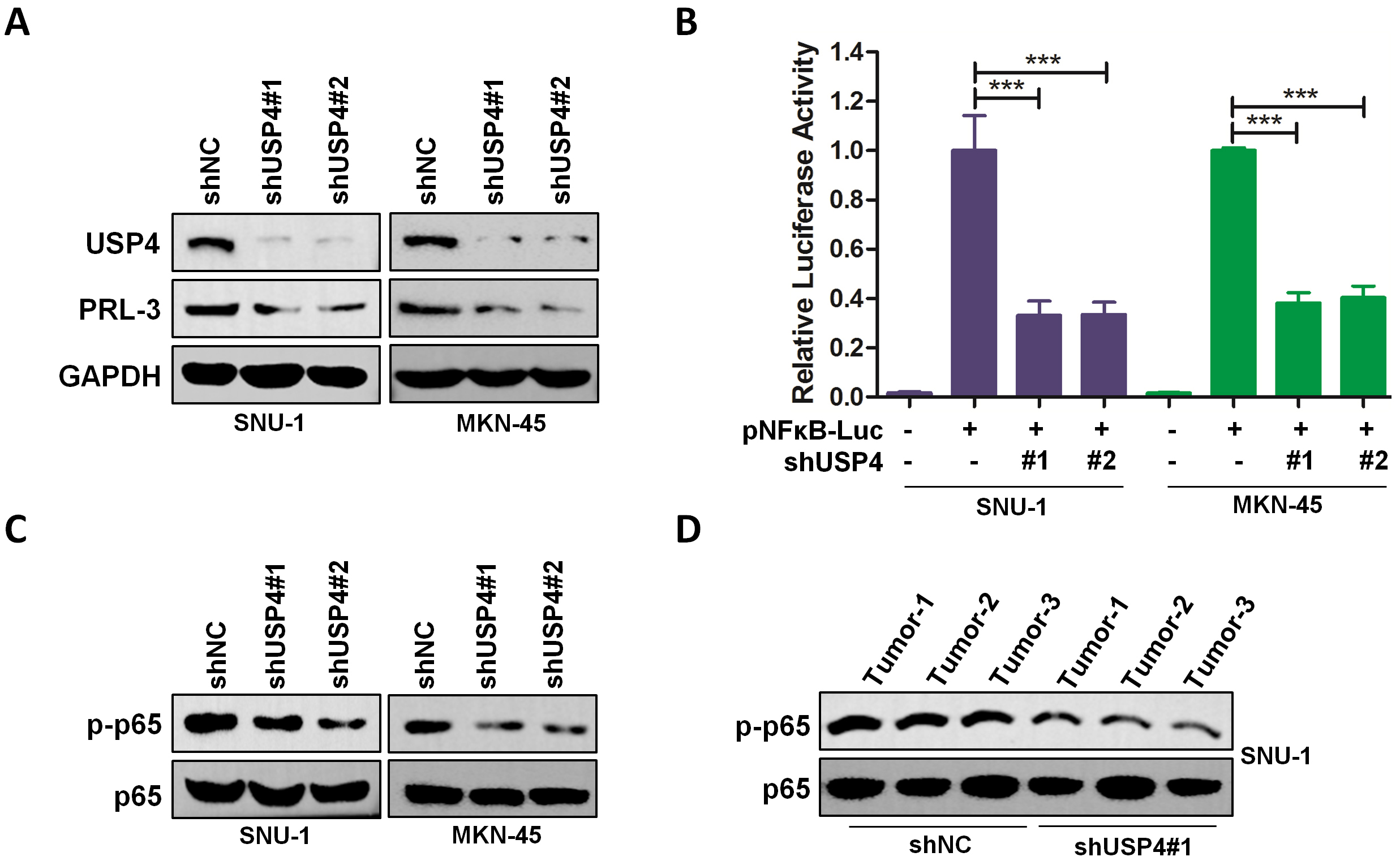 The Deubiquitinating Enzyme USP4 Functions as an Oncoprotein in Gastric ...