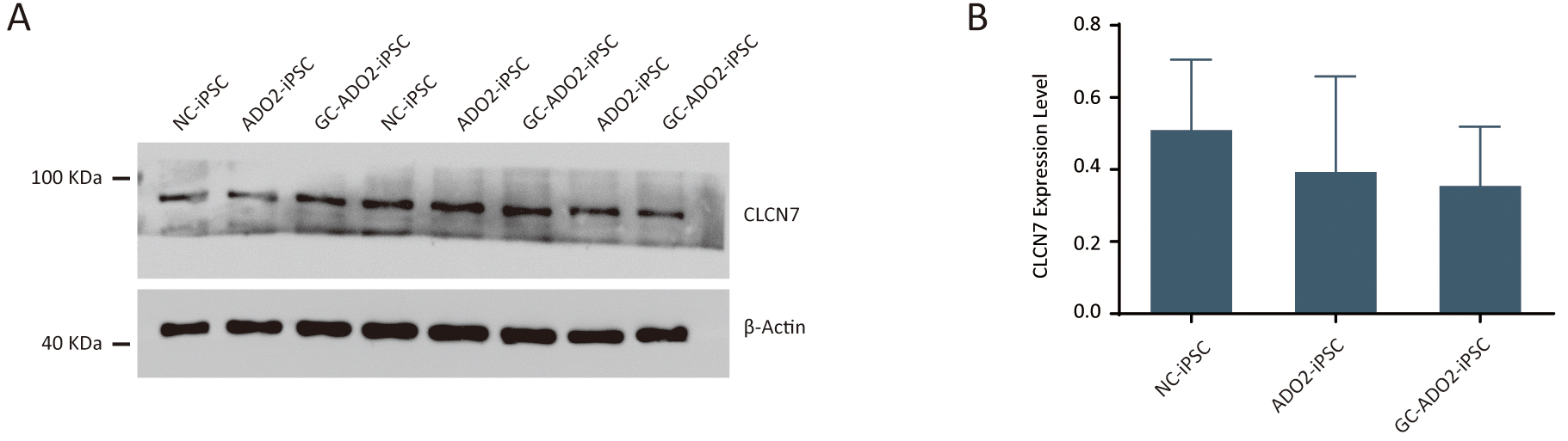 CRISPR/Cas9-Mediated Gene Correction in Osteopetrosis Patient-Derived iPSCs