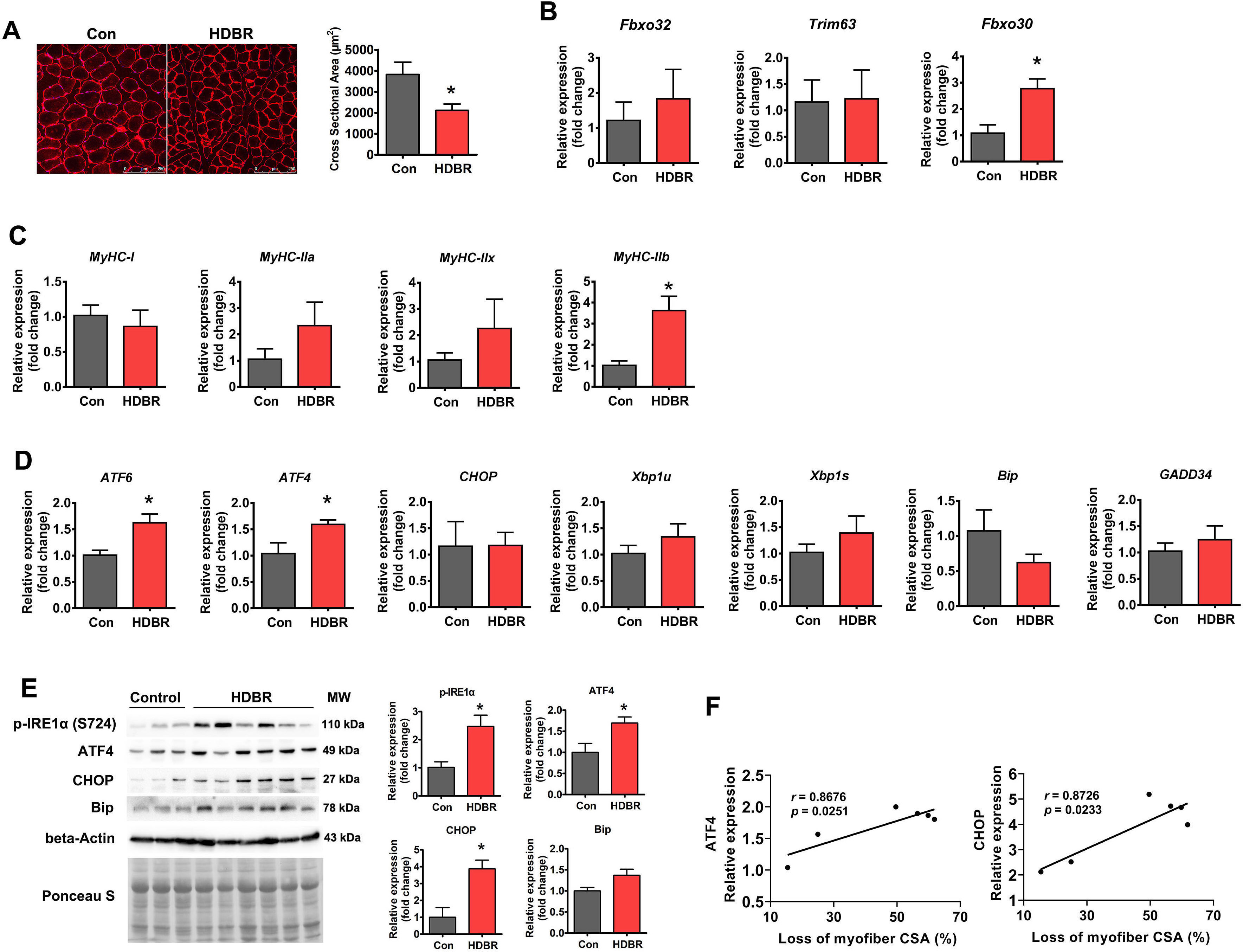 ER Stress is Activated and Involved in Disuse-Induced Muscle Atrophy