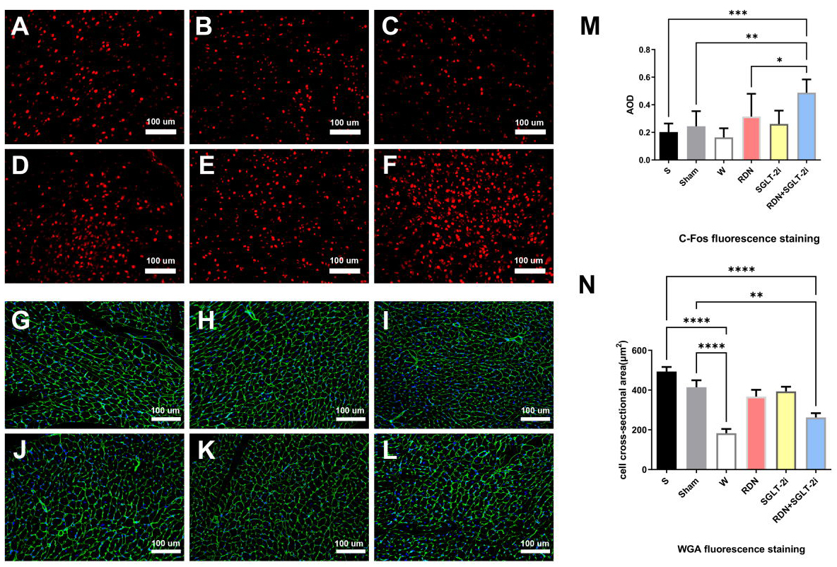Sodium-Dependent Glucose Transporter-2 Inhibitor Enhances the ...