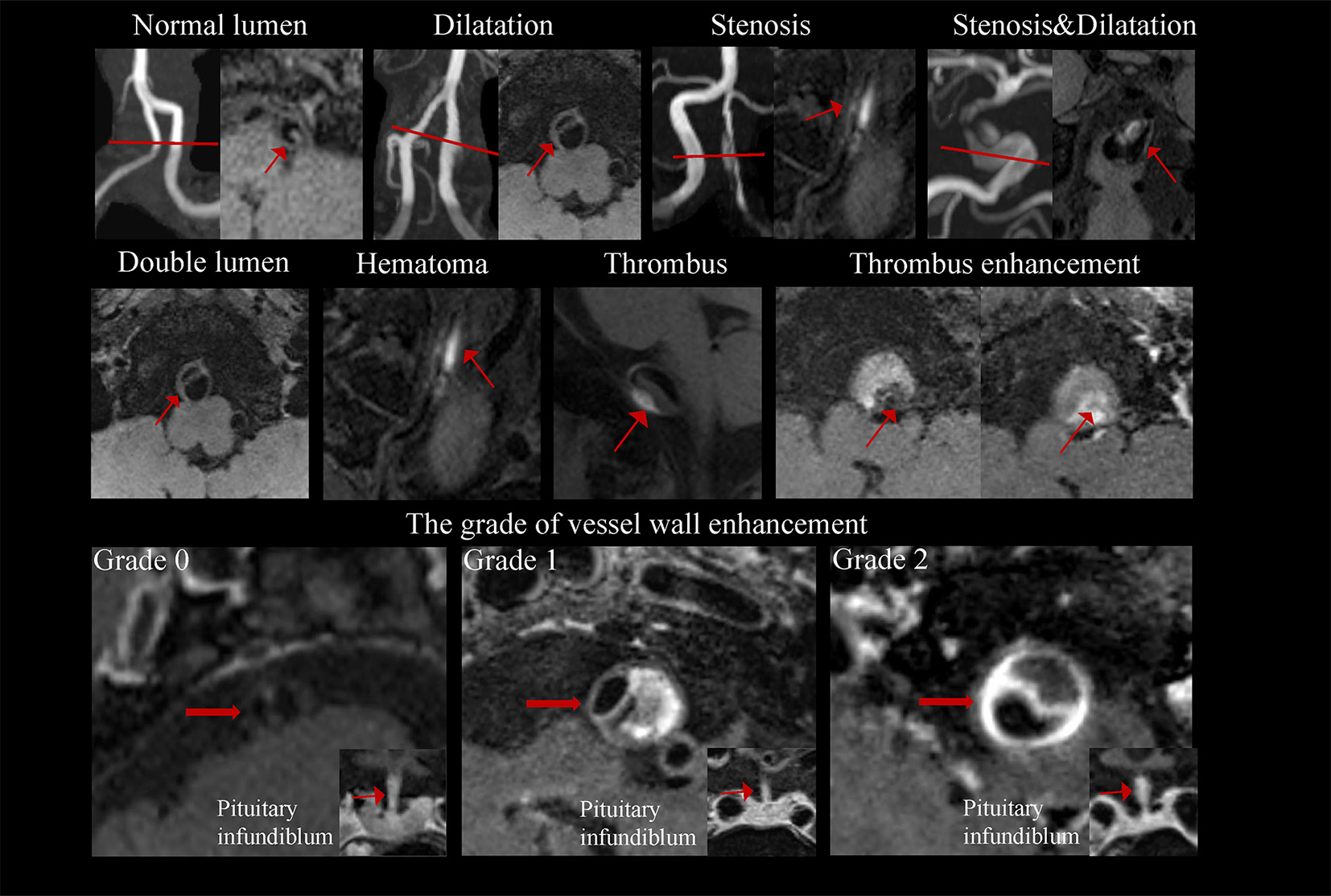 Assessment of Morphological Features and Imaging Characteristics of ...
