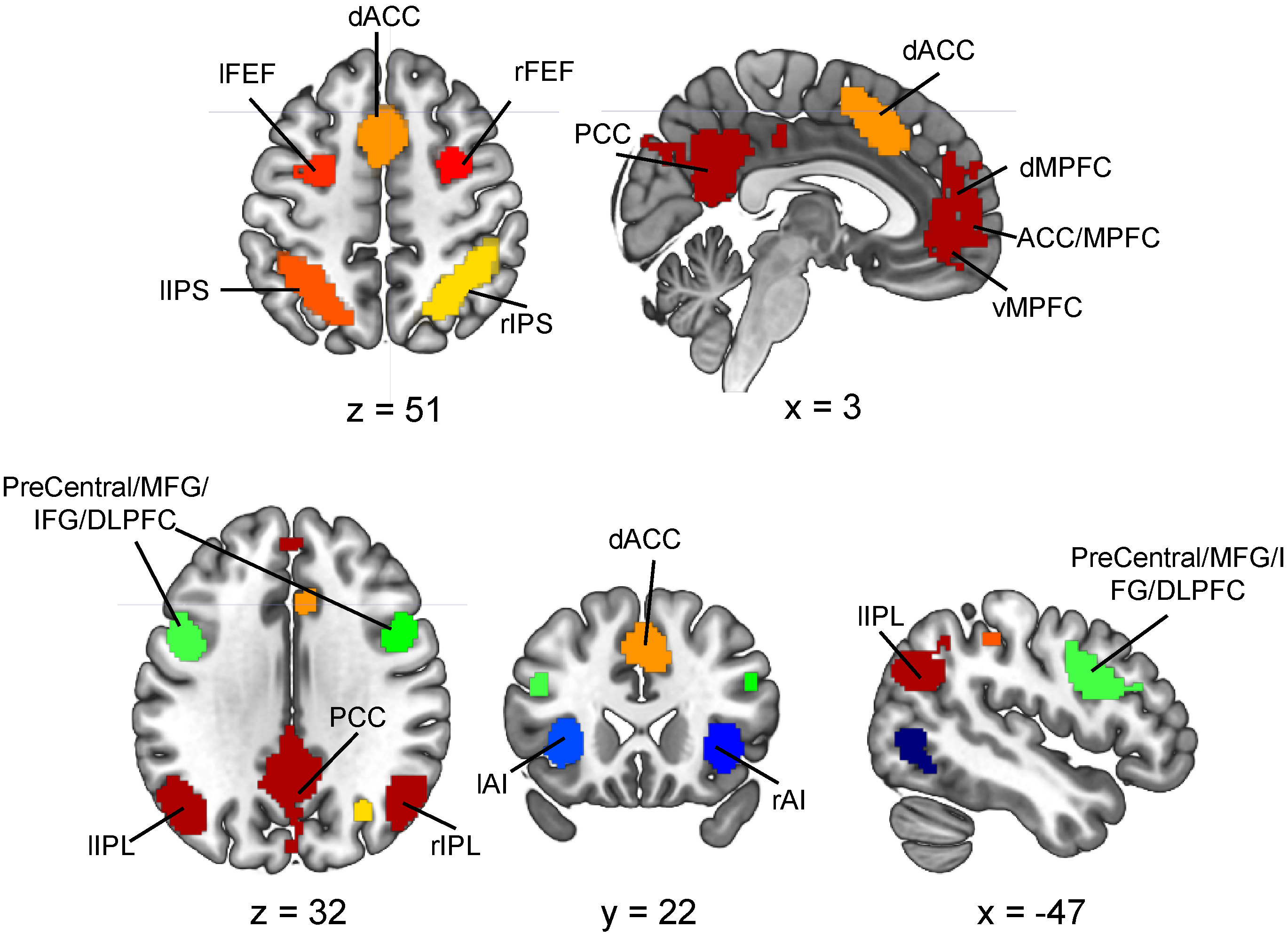 Exploring the Lifelong Changes of Interaction between Cingulo-Opercular ...