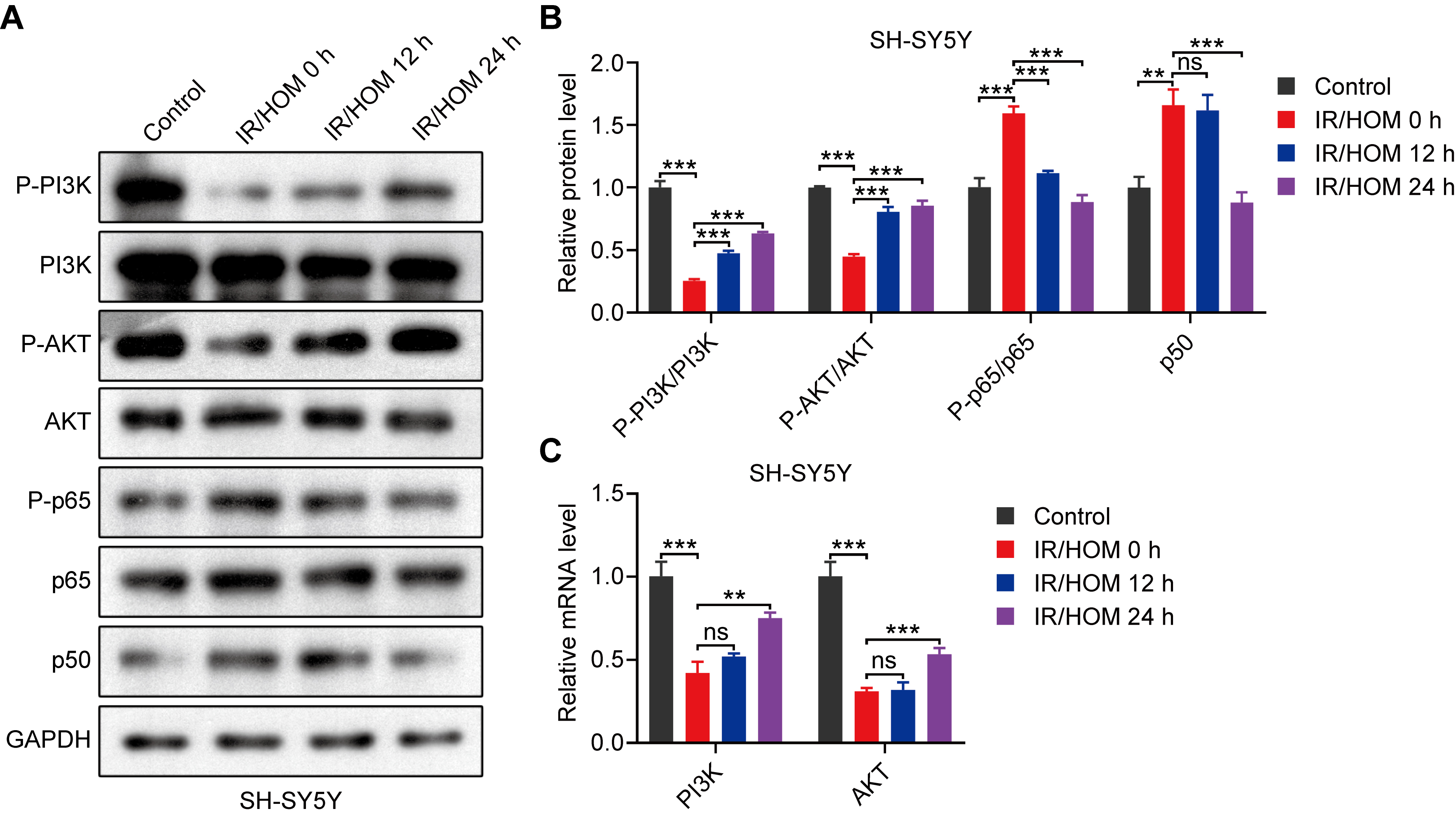 Heliox Protects SH-SY5Y Cells from Oxygen-Glucose Deprivation ...