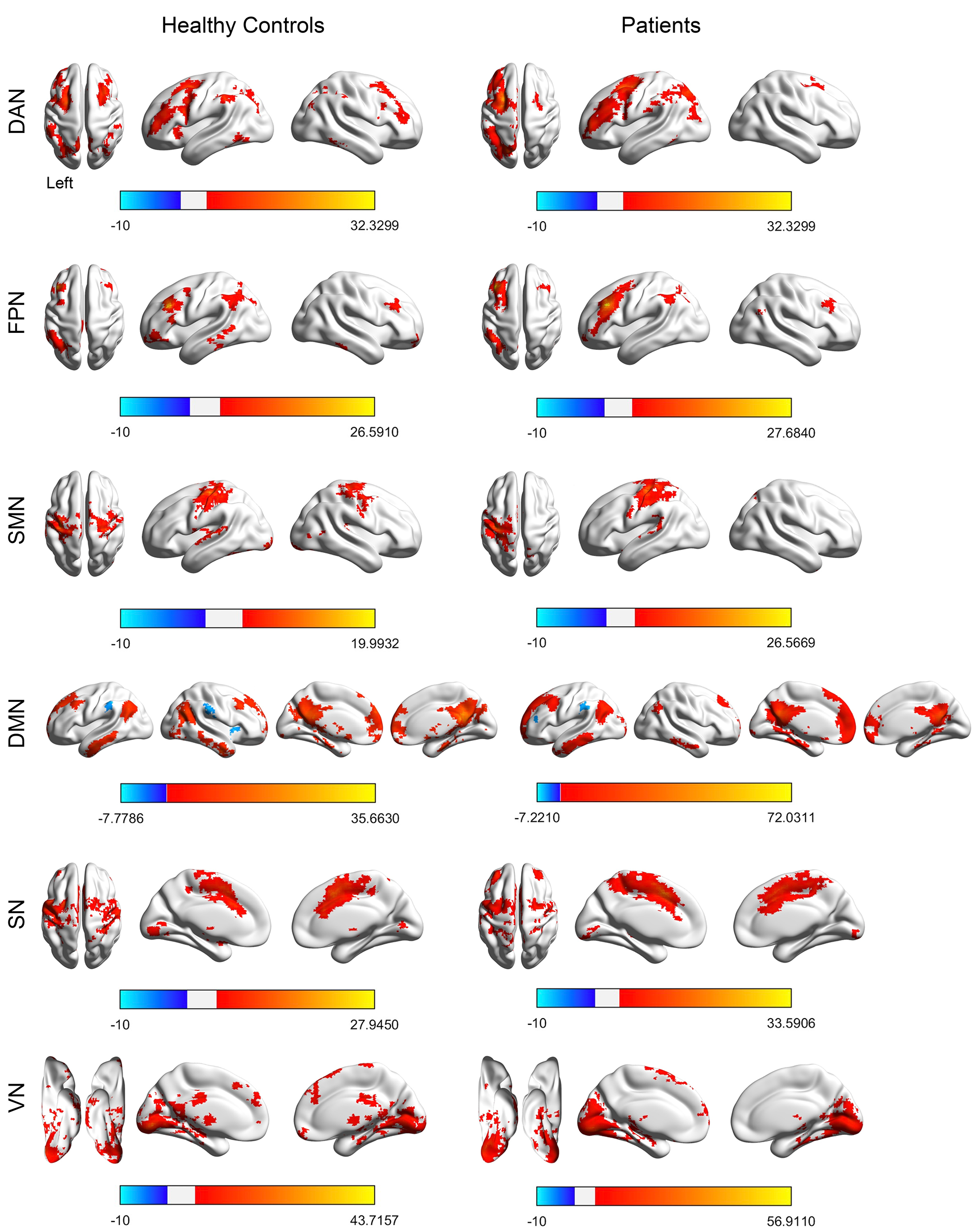 Impact of Endovascular Revascularization on Functional Connectivity and ...