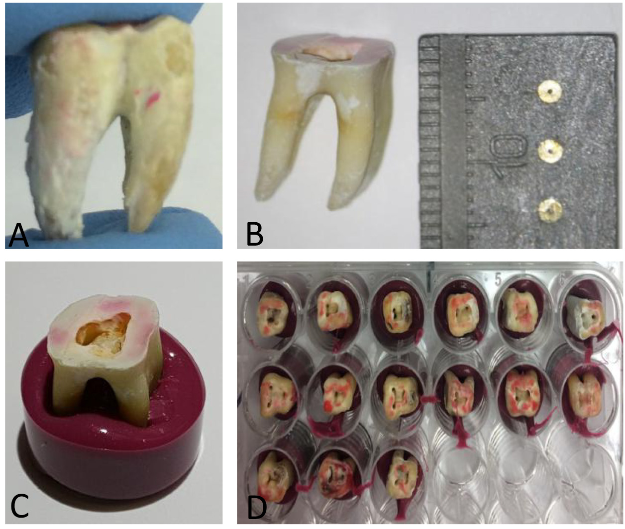 Quantitative Analysis of Biofilm Removal Following Instrumentation with ...